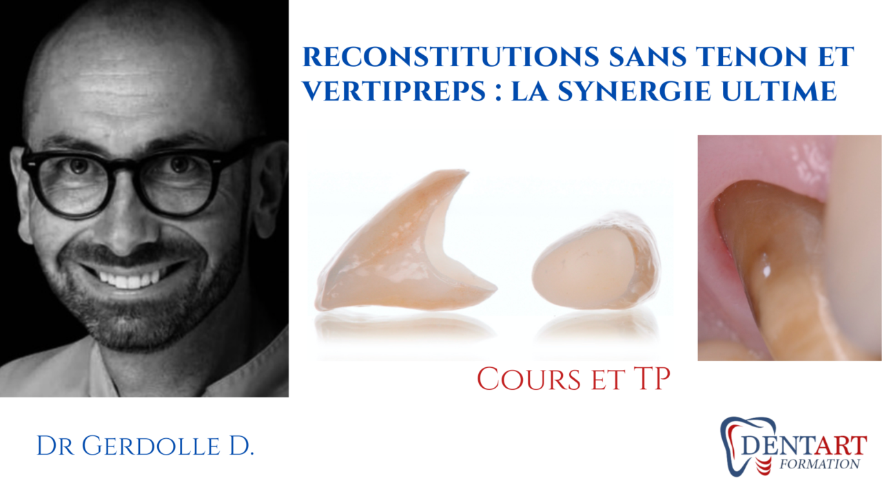 Reconstitution corono-radiculaire sans tenon et Verti-prep avec le Dr ...