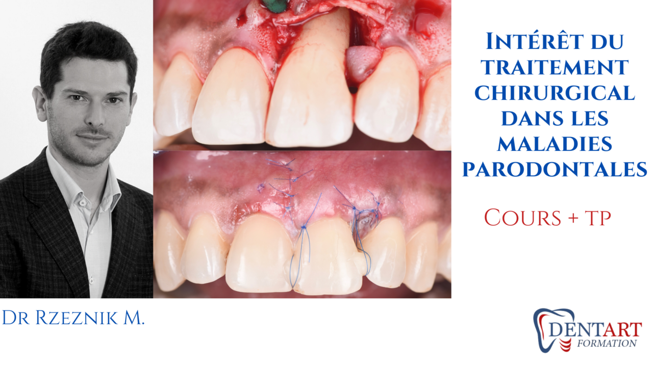 Parodontie chirurgicale | Formation Dent Art